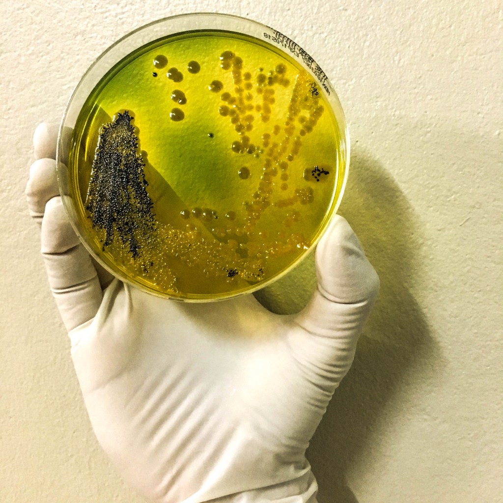 The costs and cost-effectiveness of a two-dose oral cholera vaccination ...